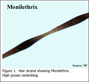 Hair Histology: Part 1 - Blog - Rankinbiomed